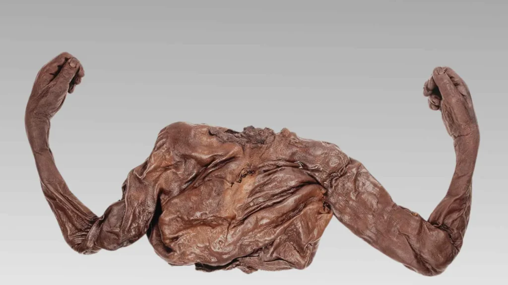 Bog Bodies Dublin, Ancient Remains At National Museum